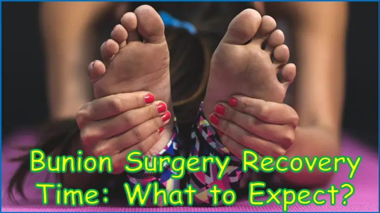 Bunion Surgery Recovery Time [Week By Week]