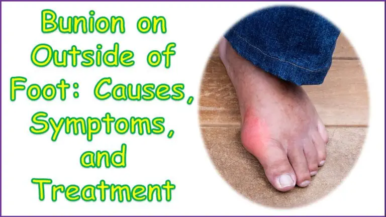 Bunion Causes - BUNION DR