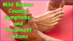 Bunion Causes - BUNION DR