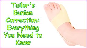Tailor's Bunion Correction: Everything You Need To Know