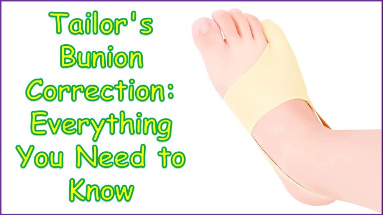Tailor's Bunion Correction: Everything You Need To Know