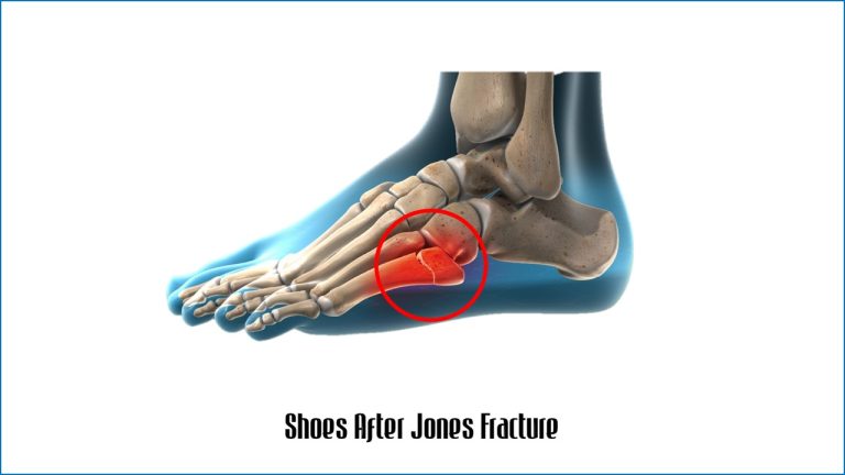 Best Shoes After Jones Fracture: Complete Recovery & Support Guide ...